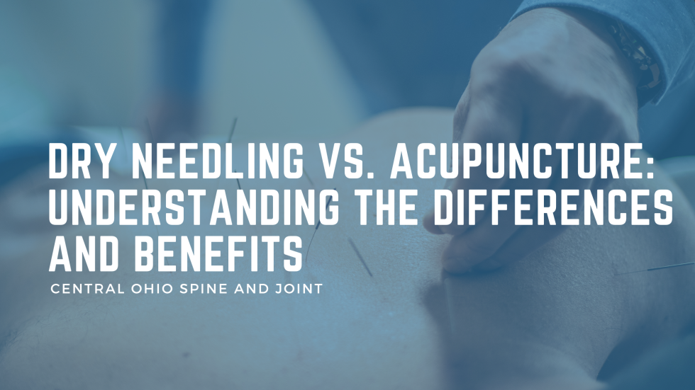 Dry Needling vs. Acupuncture: Understanding the Differences and Benefits - Central Ohio Spine ...