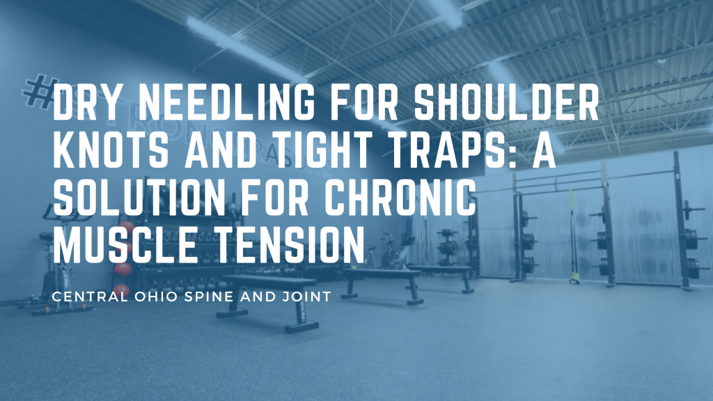 Dry Needling for Shoulder Knots and Tight Traps: A Solution for Chronic ...