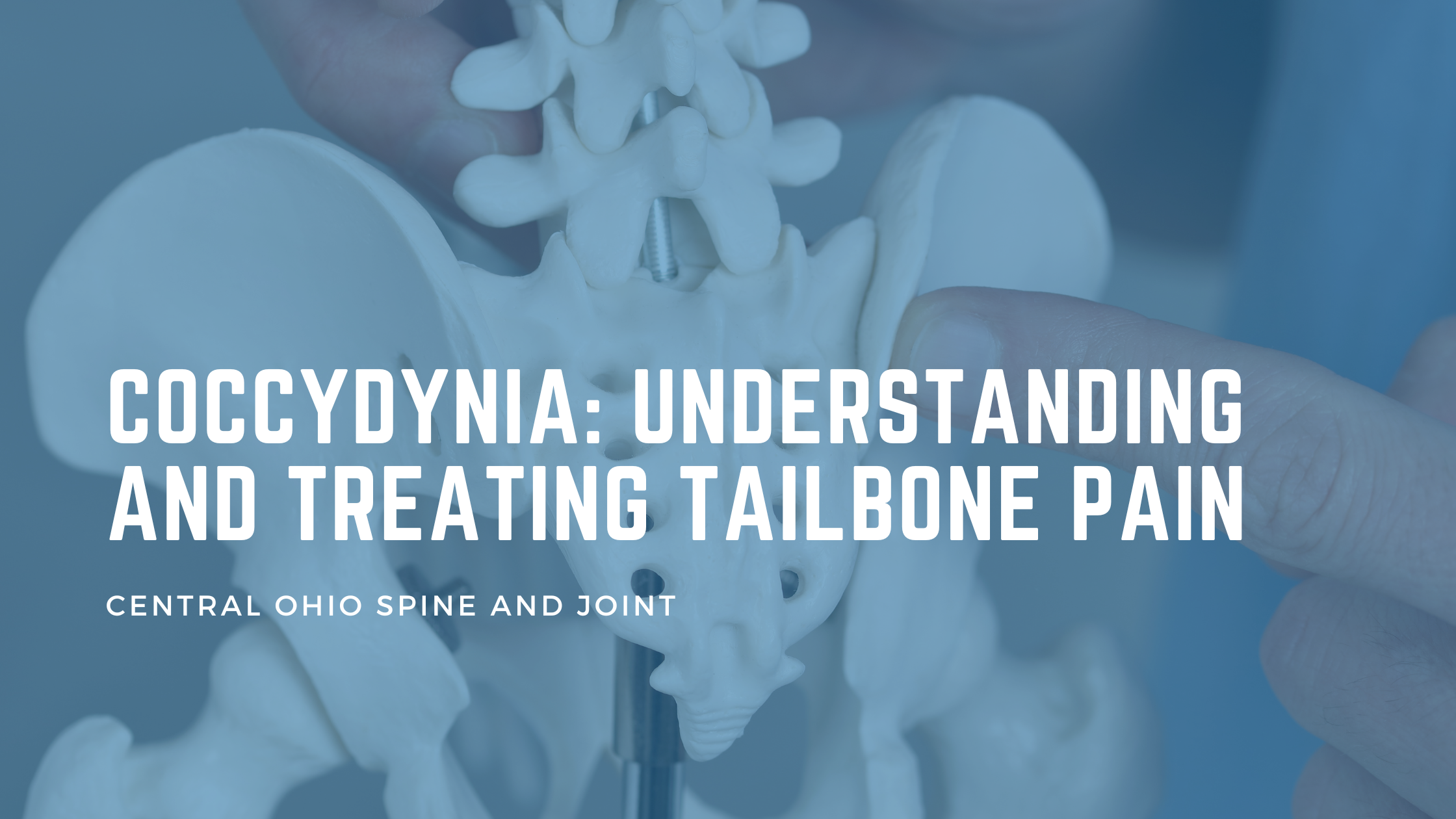 Coccydynia: Understanding and Treating Tailbone Pain - Central Ohio ...